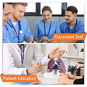 Lung Model Set | Human Body Anatomy Replica of Lung Cancer for Doctors Office Educational Tool | GPI Anatomicals