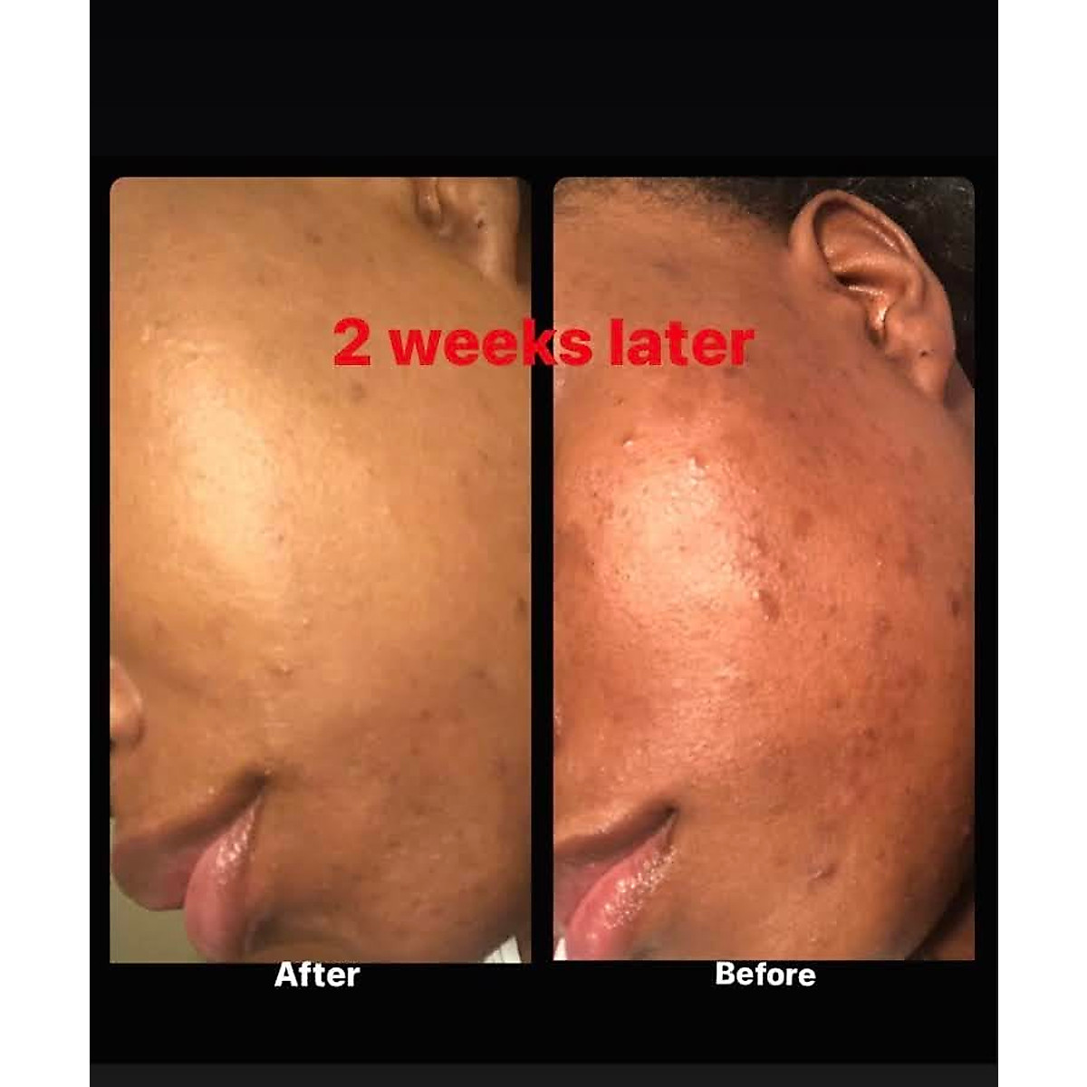 SEA MOSS COLLAGEN Hair & Skin Oil (Dandelion-Rose Dandruff & Acne)