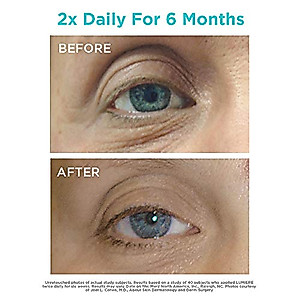 NEOCUTIS Lumière Illuminating Eye Cream | 5 Month Supply | Under Eye cream for anti-aging | Minimizes under eye darkness & reduces puffiness | Boosts Collagen for brighter, younger-looking eyes,1 Count (Pack of 1)