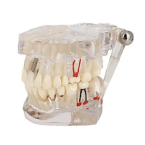 Smedent Dental Study Teaching Teeth Model Adult Typodont Model Removable Tooth