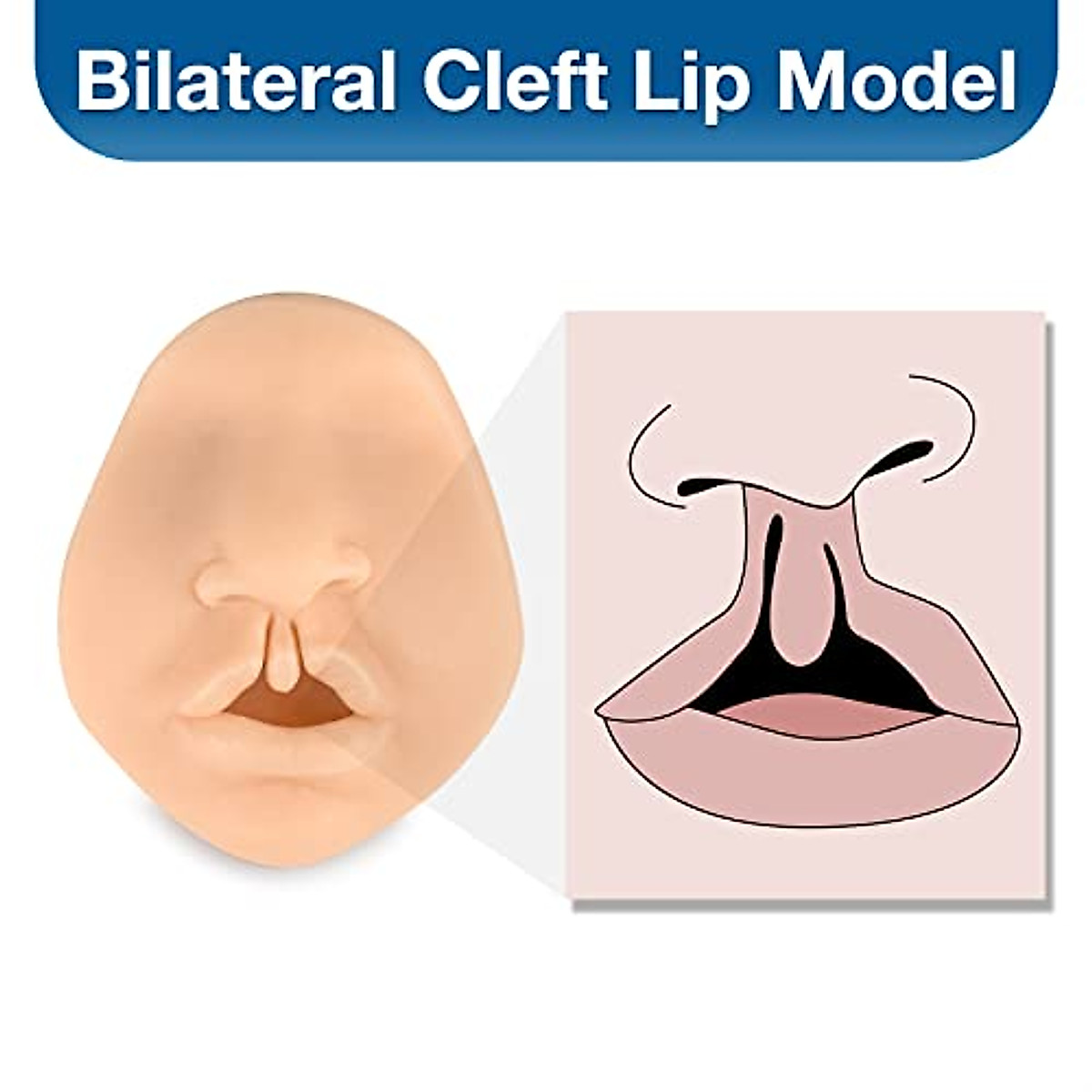 Ultrassist Bilateral Cleft Lip Model, Cleft Lip Suture Training Simulator for Medical Students, Education, Display