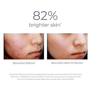 DERMA-E Vitamin C Intense Night Cream – Brightening and Hydrating Facial Skin Renewing Cream – Anti-Aging Overnight Facial Moisturizer, 2 oz