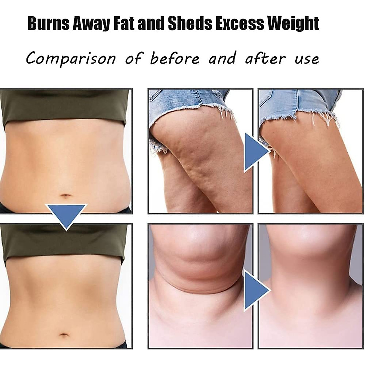 Nubudoz EMS Neck Acupoints Lymphvity Massager Device, Lymphatic Drainage Machine, 12 Modes EMS Neck Massager for Pain Relief, Portable Neck Lymphatic Massager for Women Men Gift (A)