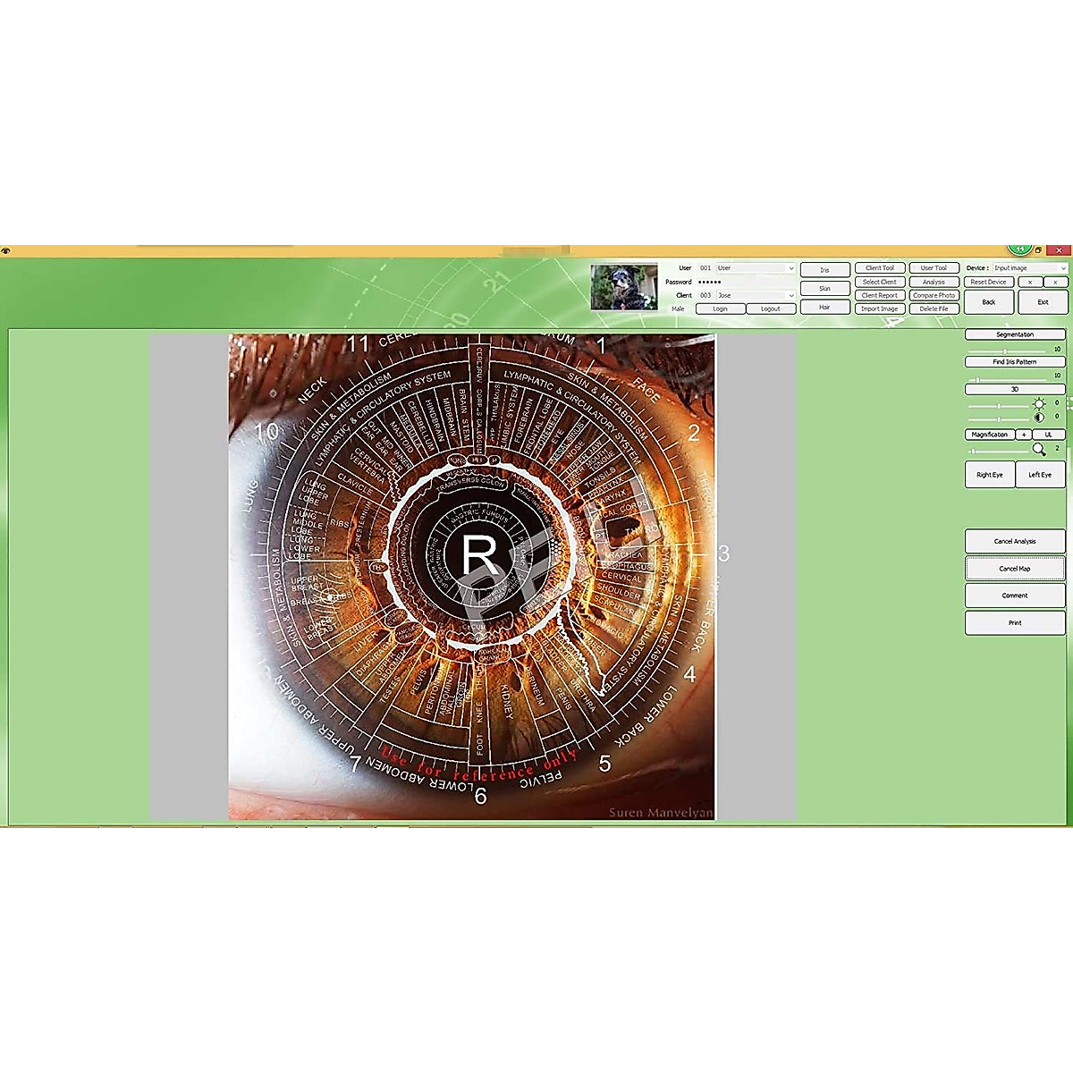 Iriscope Iridology Camera 5.0 MP LED Light Iris Analyser Iridoscope iriscopio