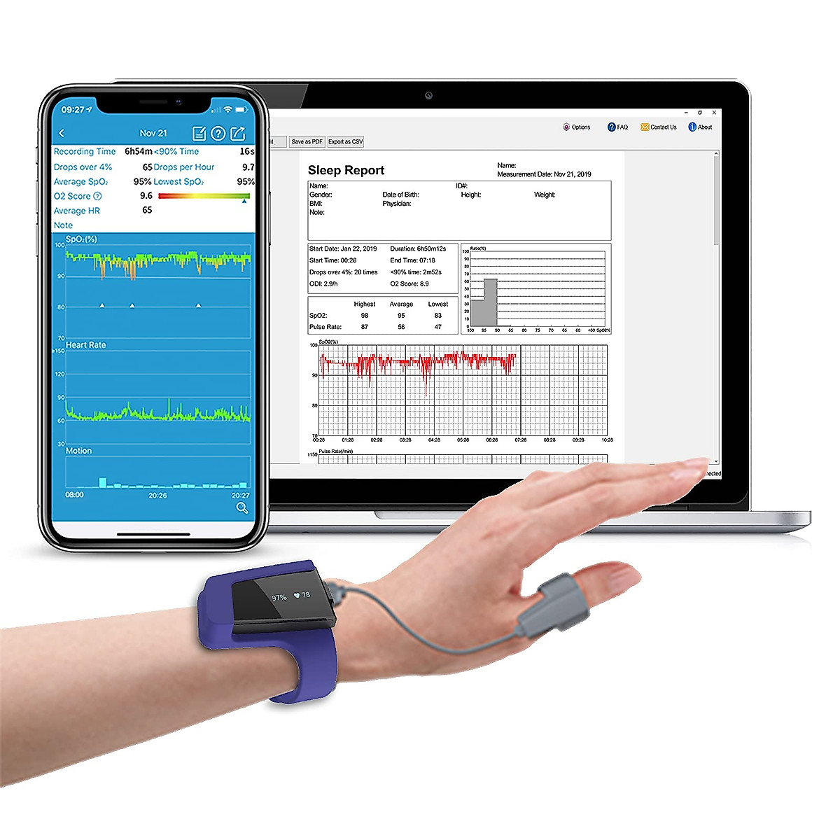 Wellue Sensor Ring, Viatom Sleep Ring for SleepU & Visual oxy & CheckmeO2 max