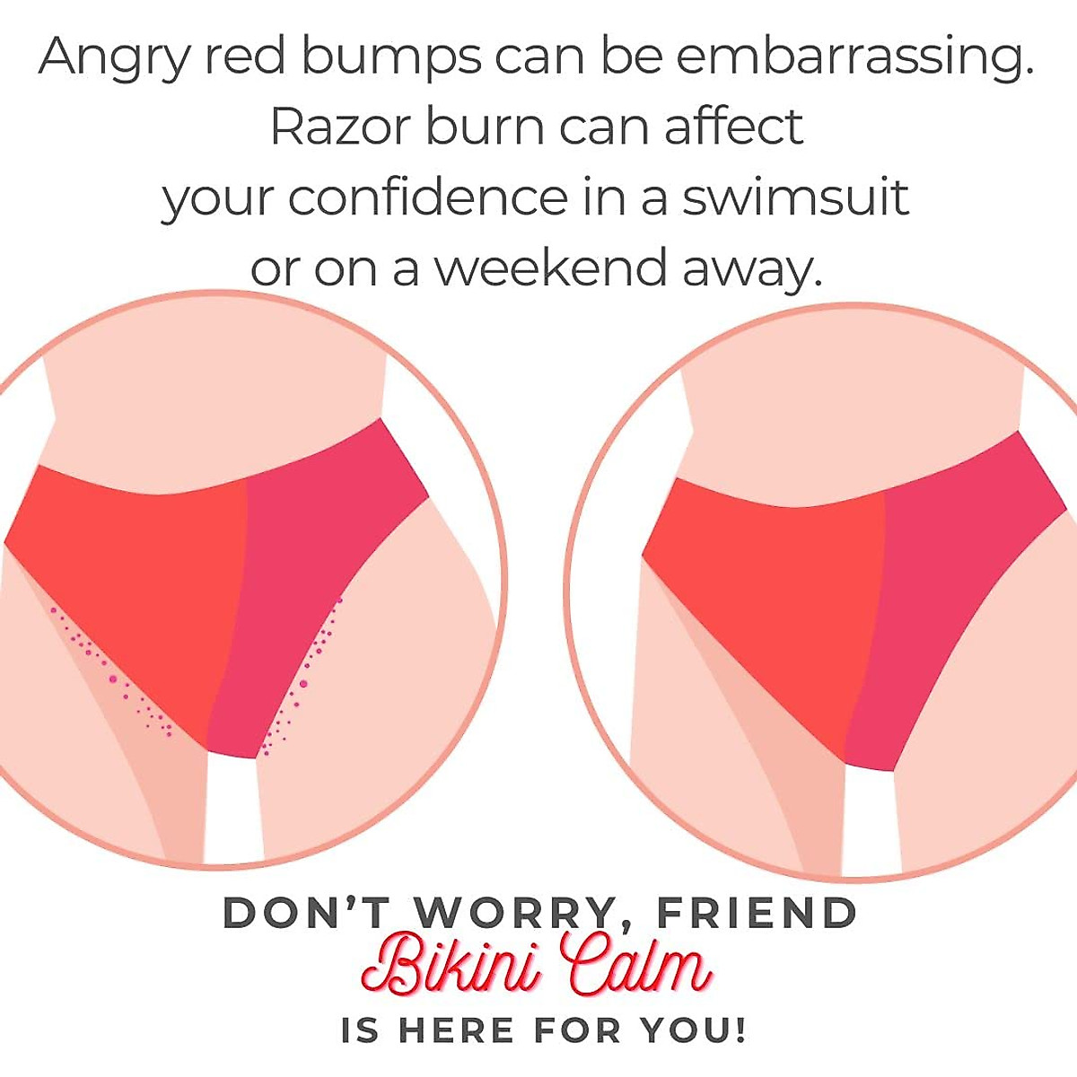 Bikini Calm Razor Burn Relief (Full Size, 8 oz.)