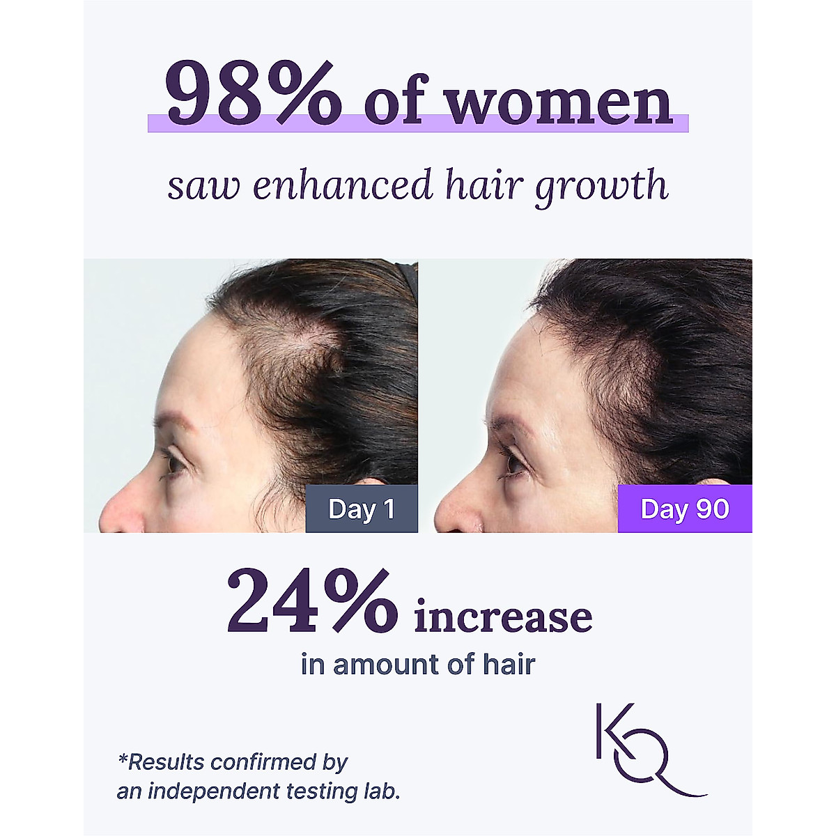 Keranique Hair & Scalp Supplements - Promote Strength and Growth Best for Thinning Nourish Your with Biotin, Vitamin B, More Vital Nutrients Keraviatin