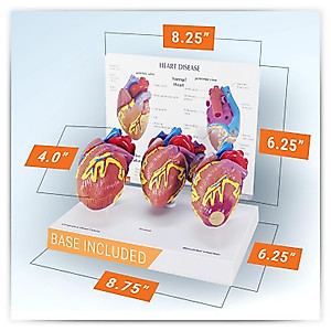 Heart Model Set | Human Body Anatomy Replica Heart Disease Set for Doctors Office Educational Tool | GPI Anatomicals