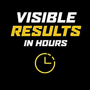 Ortho WeedClear Weed Killer for Lawns: with Comfort Wand, Won't Harm Grass (When Used as Directed), Kills Dandelion & Clover, 1 gal.