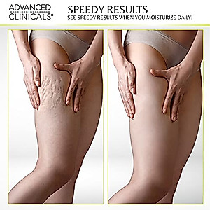 Advanced Clinicals Thermo-Firming Green Coffee Bean Moisturizer Body Cream | Anti Cellulite Caffeine Firming Lotion For Legs, Arms, & Body | Skin Care Products | Aging Skin Tightening Cream, 2-Pack