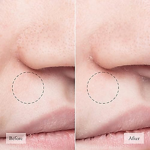 philosophy purity made simple pore extractor mask