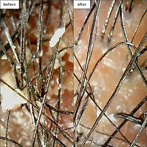 Briogeo Scalp Revival Soothe + Detoxify Minis Kit, Soothe a Dry, Flaky, Itchy Scalp, Clarify Build Up, Scalp Detox, Unclog Hair Follicles,Travel Kit, Vegan, Cruelty-Free, 4-Piece Set