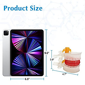 SKUMOD Human Lumbar Disc Herniation Model, Transparent Lumbar Spine Model, Lumbar Disc Anatomical Model with Elastic Software