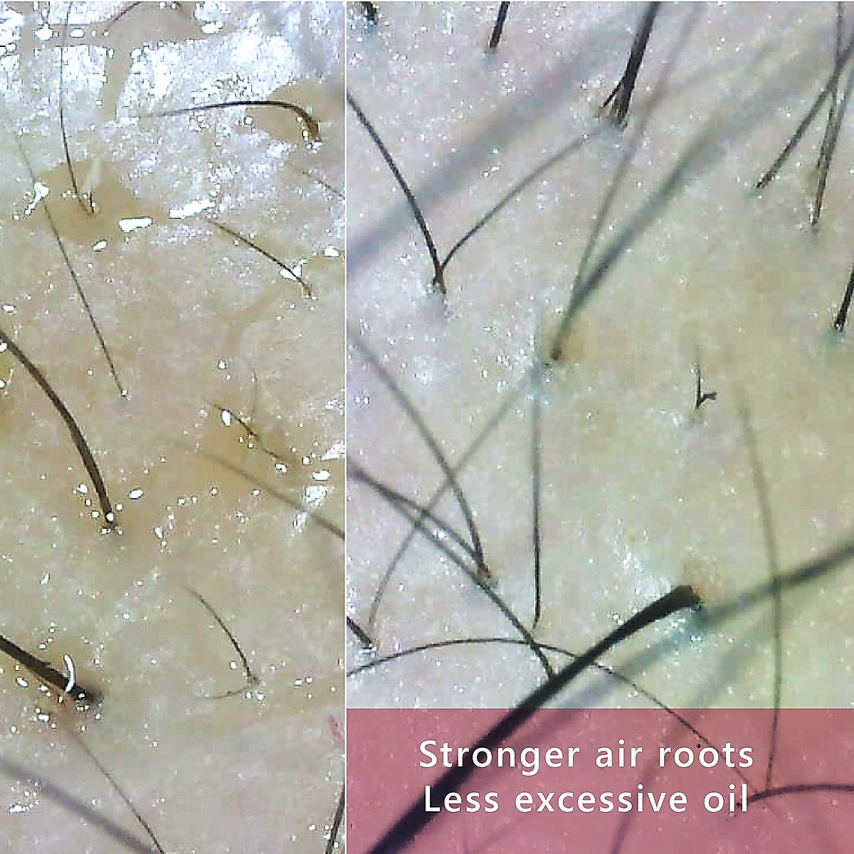 AROMASE Rose Hair Volumizing Essential Shampoo for Hair Loss, Shedding hair, Thinning hair with Natural DHT Blocker-5α AVOCUTA adds Volume For Oily, Flat Hair, Damask Rose Oil fragrance 14.1 Fl. Oz