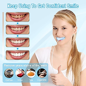 Teeth Whitening Kit Tooth Whitener - DOUCEUR Dental Bleaching System Professional with 16X LED Mouth Tray Light 5Pcs Whiting Gel Pen for Purely Whitening of Sensitive Teeth