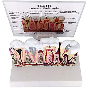 KEZaiZHe Anatomy Education Model - Teeth Cross-Section Model - Gums Model Anatomy Teeth Model Detachable Education Dental Model - for Study Display Teaching Medical Model