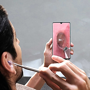 Anykit Ear Wax Removal Tool, Ultra Clear View Ear Scope with LED Lights for Ear Cleaning, Ear Cleaner Camera Otoscope with Ear Spoon & Specula for Phone & Tablet