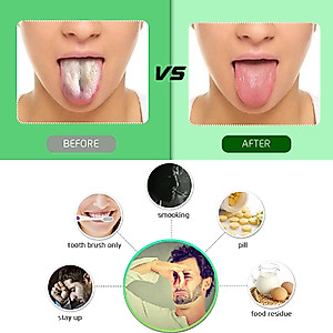 New Tongue Scraper, Premium Tongue Cleaner, Keep Oral Hygiene, Metal Tongue Scrapers, BPA Free, Medical Grade Stainless Steel, For Adults Kids, Bad Breath Treatment Tools