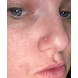 Longita 20g 18g Clear Nose Studs Clear Nose Rings for Work Plastic Nose Rings for Surgery Clear Earrings Plastic Earrings 16g Clear Cartilage Earrings