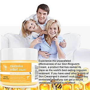 UEUEKOKO Eczema Psoriasis Manuka Relief Honey Cream, Hand Foot, Tinea Versicolor, Itchy Feet, Butt, Anal Itch, Scalp Dandruff, Bee Sting, Bites, Boil Cyst, Armpit, Adults Kids, Hidradenitis Treat