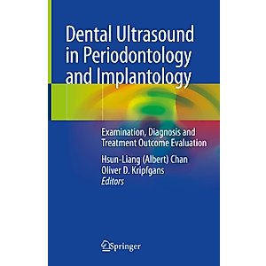 Dental Ultrasound in Periodontology and Implantology: Examination, Diagnosis and Treatment Outcome Evaluation