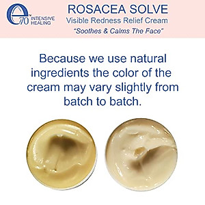 E70 Rosacea Solve - Redness Relief Cream - Calming Face Moisturizer For Rosacea and Acne-Prone Skin - Sensitive Skin Care With Organic Ingredients such as Aloe Vera, Almond Oil, Licorice and Chamomile Extracts - No Parabens