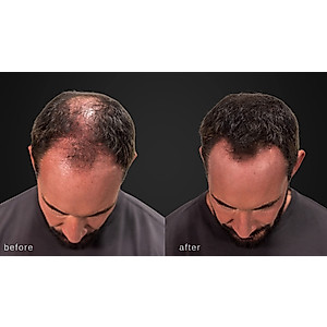 LUXE Hair Thickening Fibers - CONFIDENCE IN A JAR – 2 Months+ Supply! – Hypoallergenic, Dermatologist Tested – Multiple Colors Available (Dark Brown)