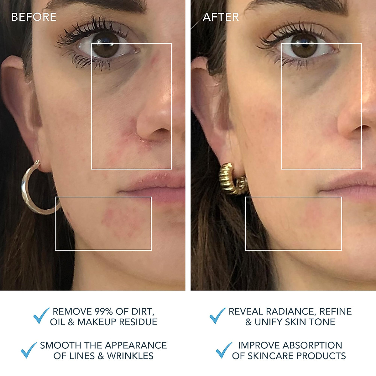 FOREO LUNA 3 Facial Cleansing Brush | Combination skin | Anti Aging Face Massager | Enhances Absorption of Facial Skin Care Products | For Clean & Healthy Face Care | Simple & Easy | Waterproof