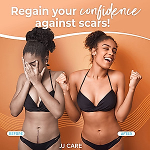 JJ CARE Soft Silicone Tape, 1.6” x 120” Flexible Silicone Scar Tape, Medical Grade Silicone Strips for Scars, Washable & Reusable Scar Tape for Surgical Scars, Latex-Free Scar Tape