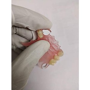 "Nesbit bridge" , Flipper Uppler and Lower Set of Affordability Flexible Valplast Customized Partial Denture (Pink, Valplast)