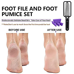 Foot Callus Remover Kit Foot File Callus Remover for Feet Pedicure Supplies Professional Metal Foot File and 20 PCS Pumice Stone for Feet Foot Scraper for Callus Removal Rough Dead Skin Removal.