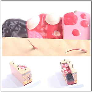 HAILIA Study Model Educational Model Skin Anatomical ModelMedical Anatomical Skin Model Burn Skin Anatomy Model for Study Display Medical Taching Model,Medical Models