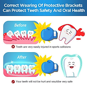 Vanmor 2 Pack Youth Mouth Guard Sports Mouthguard for Kids Teeth Braces for Football Basketball Boxing MMA Hockey Lacrosse Rugby Taekwondo, Moldable Mouthpiece for Boys Girls (Transparent+Blue)
