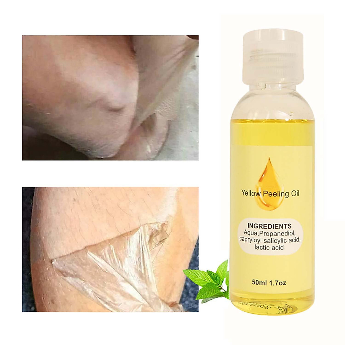 Natural Spots Whitening Yellow Peeling Oil 50ml, 1.7oz, Super Strength Yellow Peeling Oil Exfoliating for Dark Skin, Peeling Solution Bleaching Lighten Elbows Knees Hands Melanin (50ml*1pc)