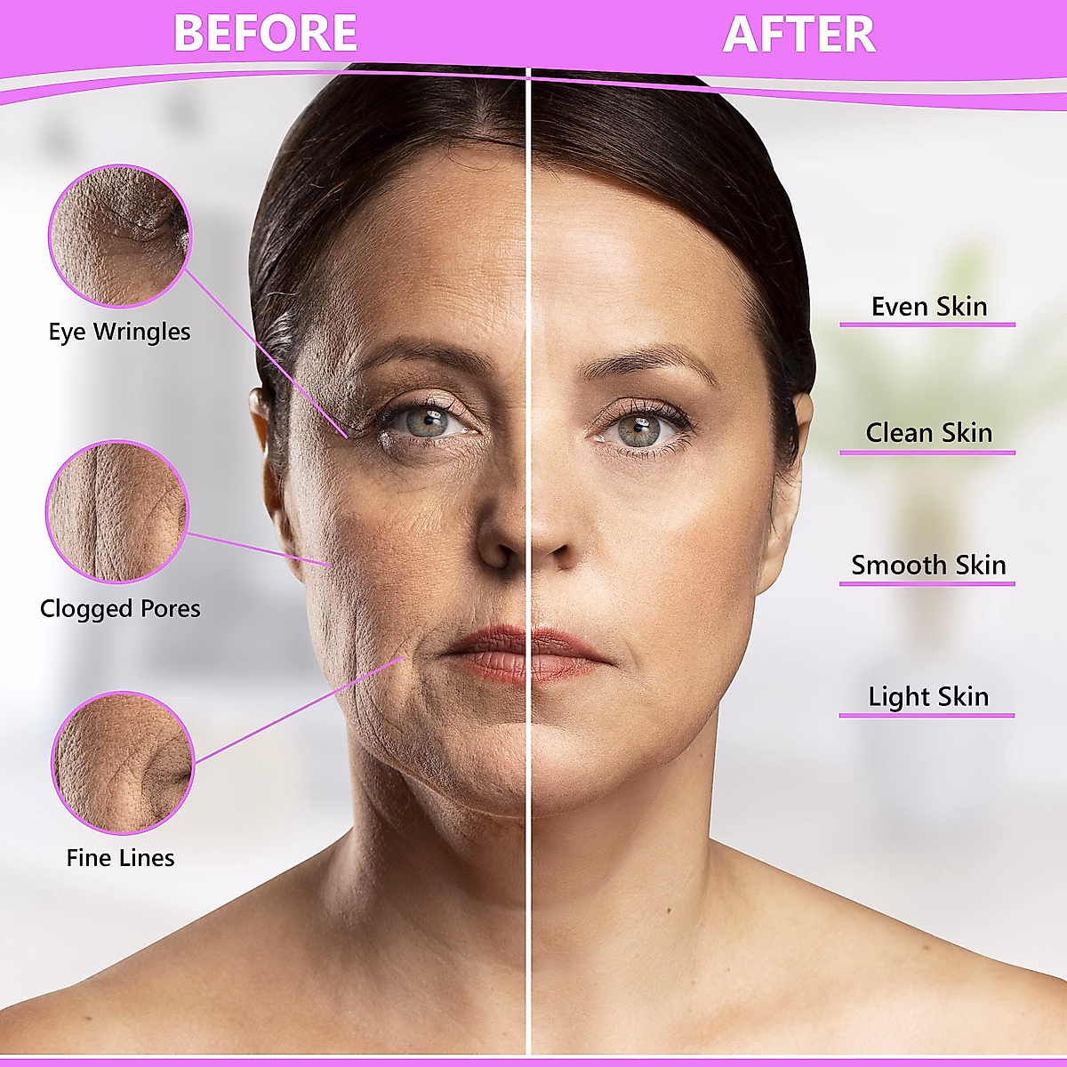 Dermal-Tech Light Therapy Face Mask Rejuvenation FDA Cleared PDT LED Facial Red Light Therapy Face & Neck Lift & Tightening Machine, Anti Aging, Dark Spot Remover Device (Flexible Silicom)