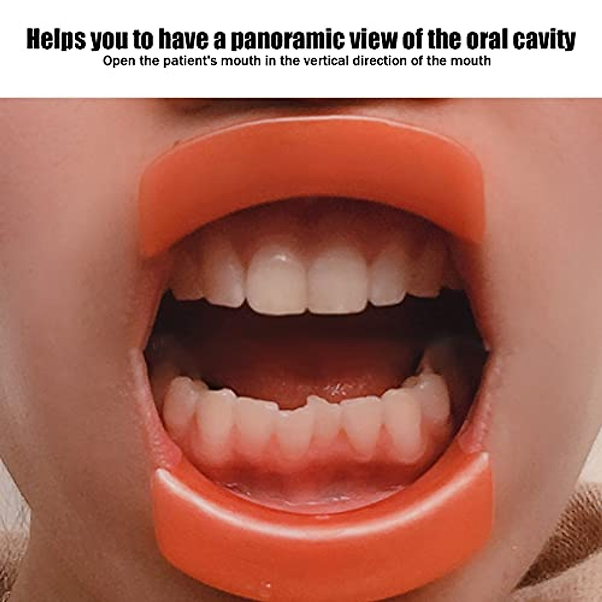 3pcs O Shape Lip Retractor - Dental O Shape Lip Retractor Opener Oral Mouth Cheek Lip Opener O Shape Mouth Opener Mouth Cheek Lip Dental Accessory