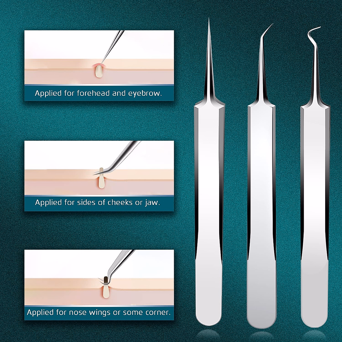 22PCS Blackhead Remover Tools, Acne Blemish Removal, Pimple Popper Extractor, Comedone Whitehead Zit Tweezers, Stainless Steel with Metal Case