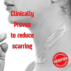 SilverSeal Burn and Wound Dressing, Hydrogel Pads with X-Static Silver, Soothing, Moist & Protective for Burns, Cuts & Wounds, 2" x 3" Sterile Dressings, 6 Count