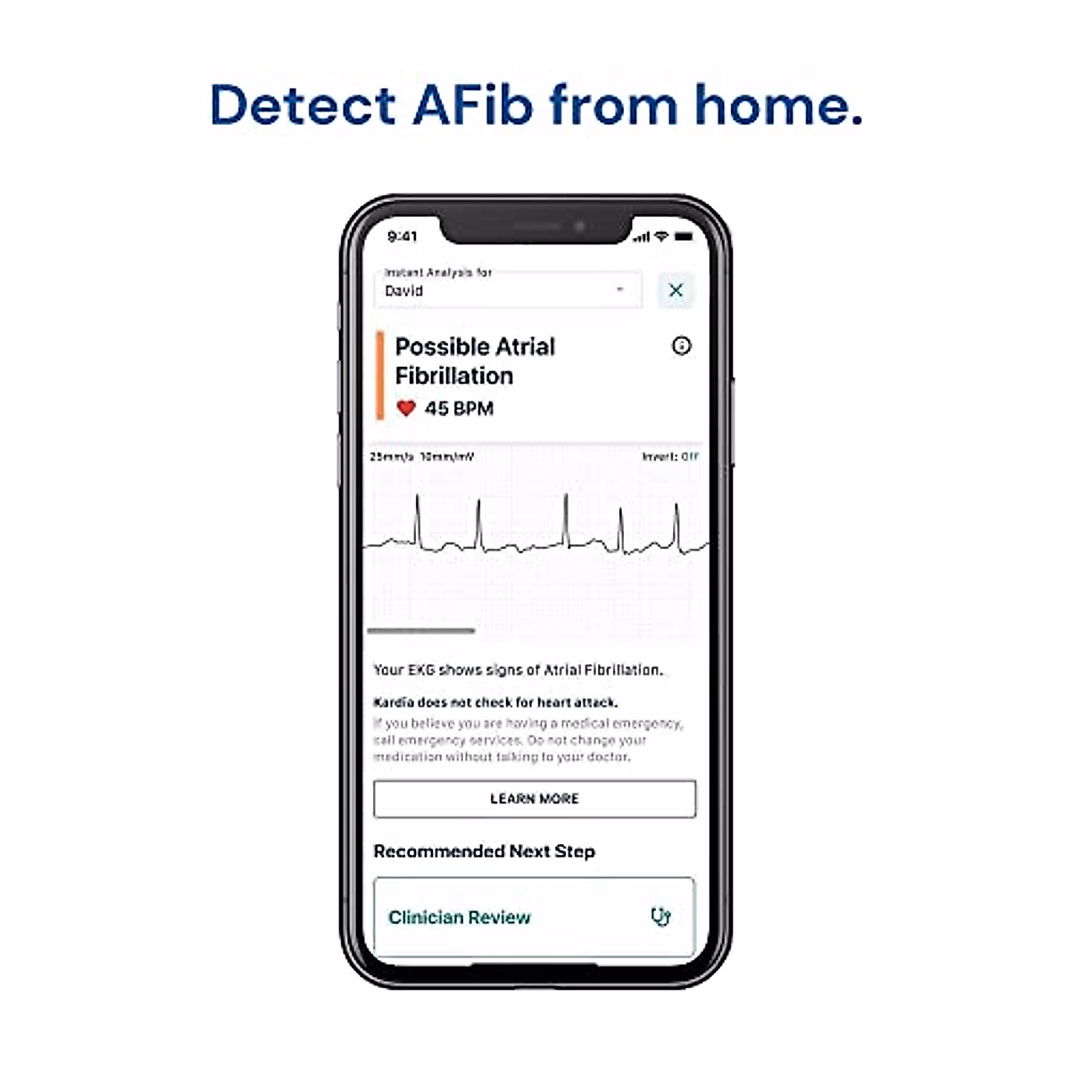 KardiaMobile 1-Lead Personal EKG Monitor – Record EKGs at Home – Detects AFib and Irregular Arrhythmias – Instant Results in 30 Seconds – Easy to Use – Works with Most Smartphones - FSA/HSA Eligible