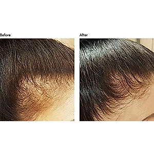 Infinix Scalp & Hair Treatment Pack-Black Seed Oil-Thick and Full & Biotin Infused-Finishing, Repair and Soothing - For irritated, Itchy Scalp - For Hair growth - Pack of 2