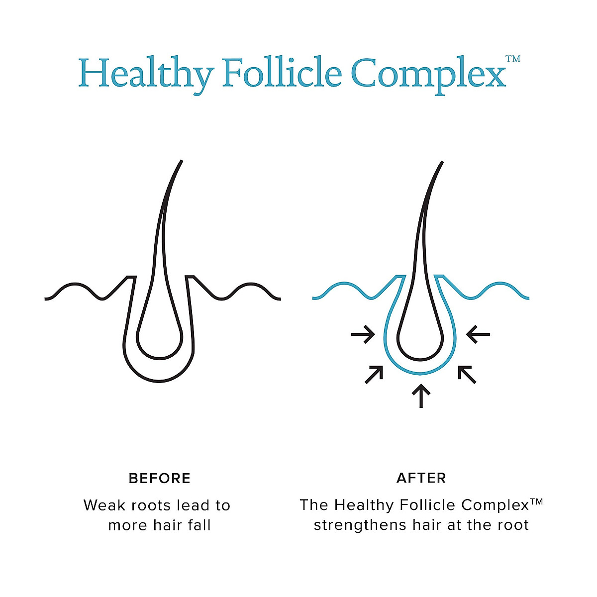 Living proof Scalp Care Revitalizing Hair Treatment for Thicker, Fuller Hair, 2.5 Fl Oz