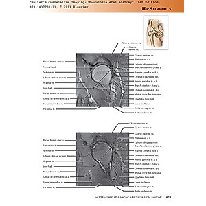 Netter's Correlative Imaging: Musculoskeletal Anatomy: with Online Access at www.NetterReference.com (Netter Clinical Science)