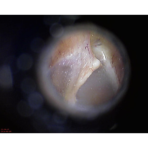 Firefly DE500 Digital Video Otoscope Ear Camera for Telehealth, Telemedicine, Audiology, Pediatrics, and Primary Care. F.D.A. and C.E. Certified.