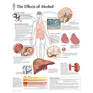 The Effects of Alcohol chart: Laminated Wall Chart