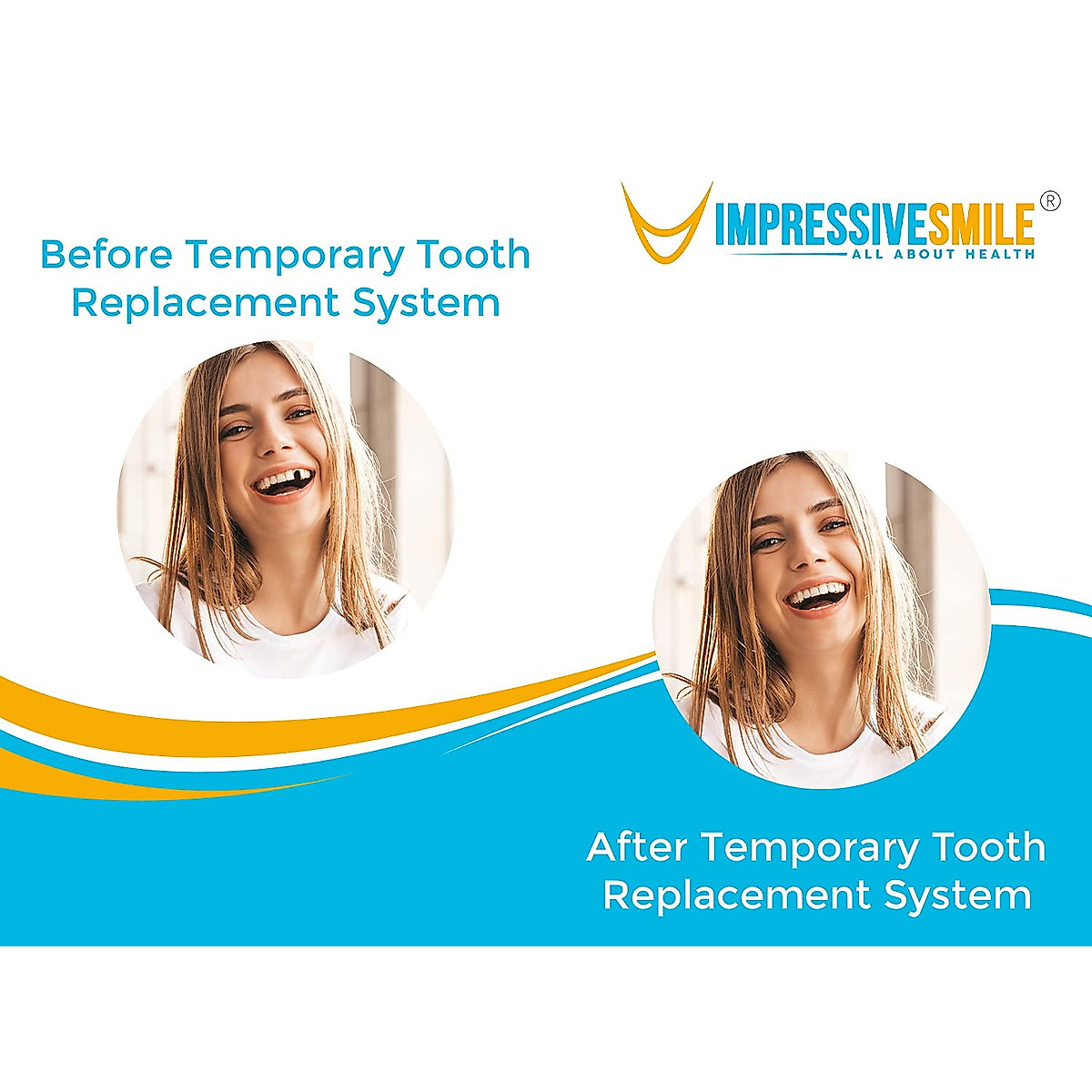 Impressive Smile Patient Trusted Temporary Tooth Replacement System