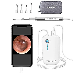 Teslong Otoscope Set with Disposable Covers, Ear Pick, 4.3mm HD Inspection Camera, 6 Adjustable LED Lights with Ear Wax Removal Tools, Works with iPhone, iPad & Android
