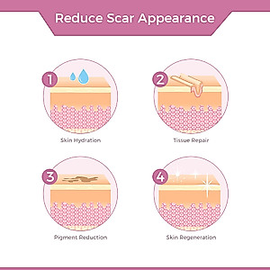 Silicone Scar Tape Scar Sheets - Professional Medical Grade Scar Removal Treatment, Non irritating, Painless for C-Section, Surgical Scars, Burn, Keloid, Acne(1.6” x 60” Roll)