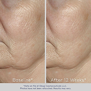 Obagi ELASTIderm Facial Serum – Firming Face Serum with Patented Bi-Mineral Contour Complex Clinically Proven to Target Signs Of Skin Aging – 1 oz