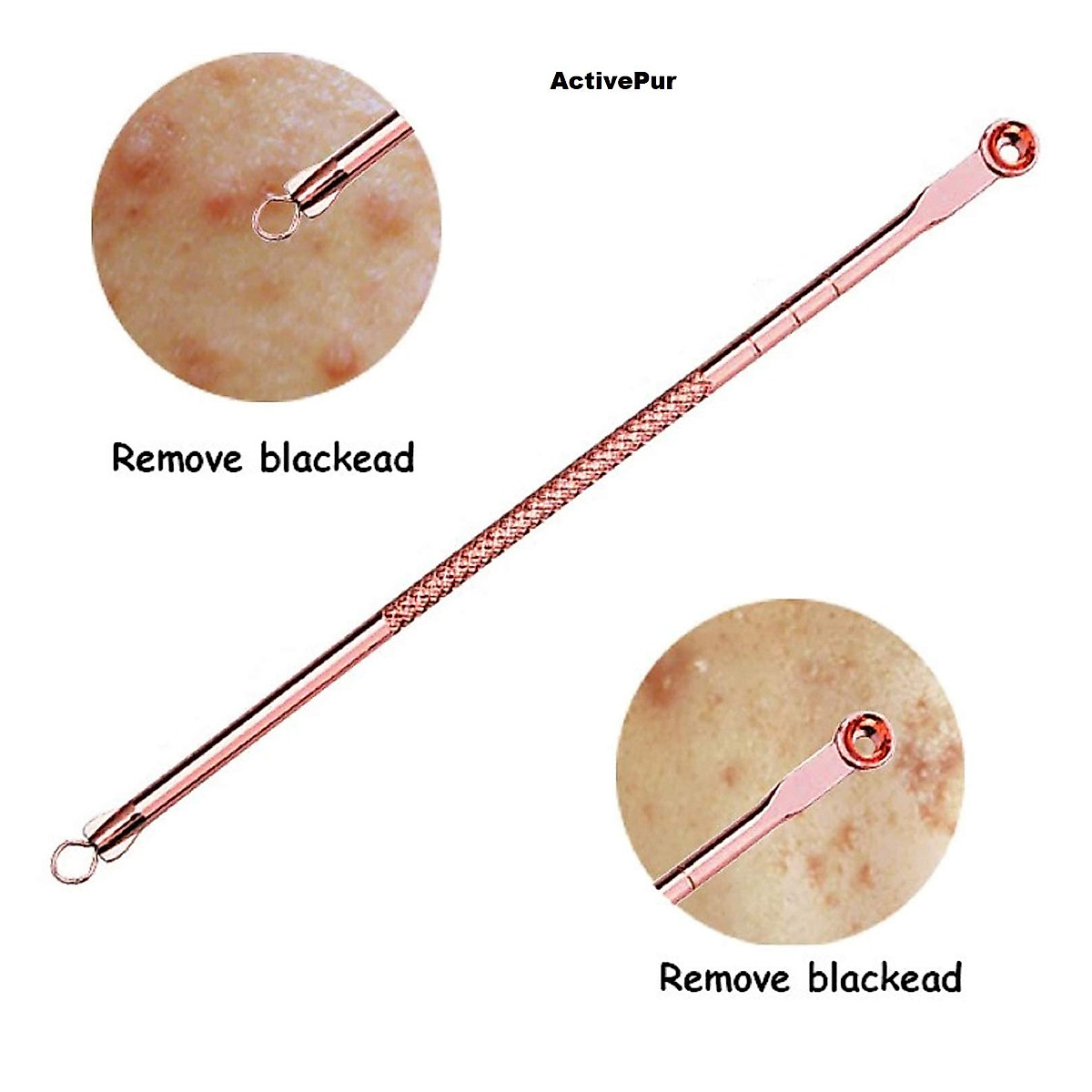 Blackhead Remover Pimple Comedone Extractor Tool, Effective Acne Removal Kit, Treatment for Blemish, Whitehead Pimple Popping, Zit Removing for Nose & Face Skin, Best Electroplated 4 PCS w/case.