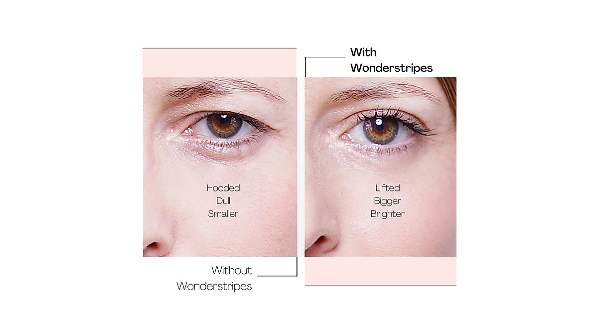 Wonderstripes Eyelid Lifting Strips for Youthful Eyes